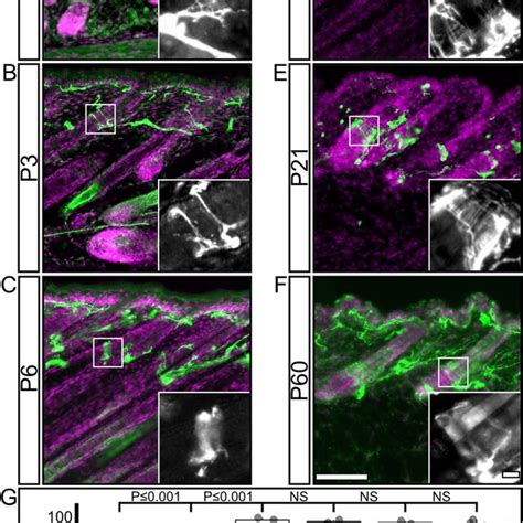 Aβ Ra Ltmr Neurons Complete Innervation Of Hair Follicles Before C Ltmr Download Scientific