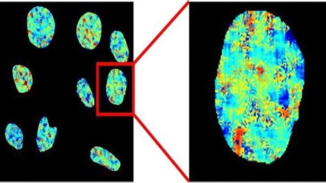 Quadruple Helix Dna Found In Living Human Cells Technology Networks