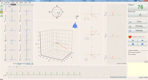 Vectorcardiogram Elearning Application Request Pdf