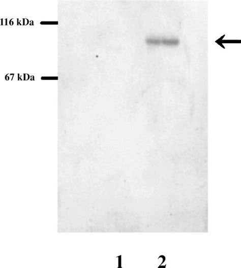 Inhibition Of Shedding Of Cd163 By Timp 3 Monocytesmacrophages
