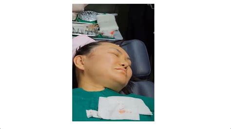 1 안전하고 효과적인 실리프팅 실습교육1 Youtube