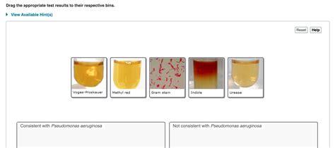 Pseudomonas Aeruginosa Gram Stain