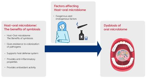 Progress In Oral Microbiome Related To Oral And Systemic Diseases An Update