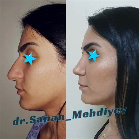 Senan Mehdiyev Sənan Mehdiyev Санан мехтиев Sanan Mehdiyev