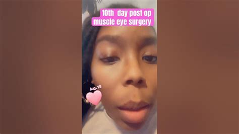 Eye Surgery Youtube
