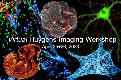 Svi Huygens On Twitter Microscopists Join Our Free Online Workshop