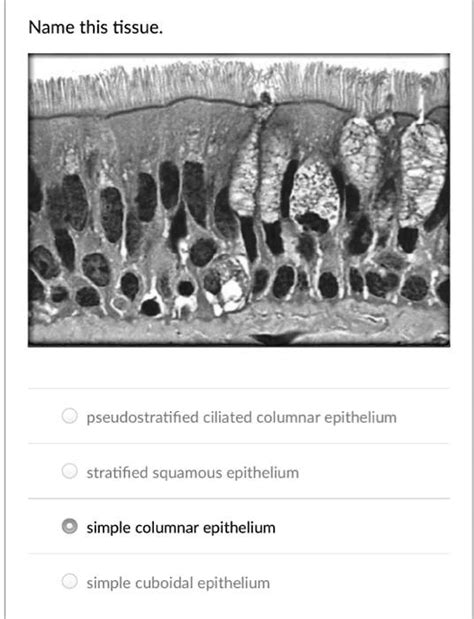 Solved Name This Tissue Pseudostratified Ciliated Columnar Epithelium
