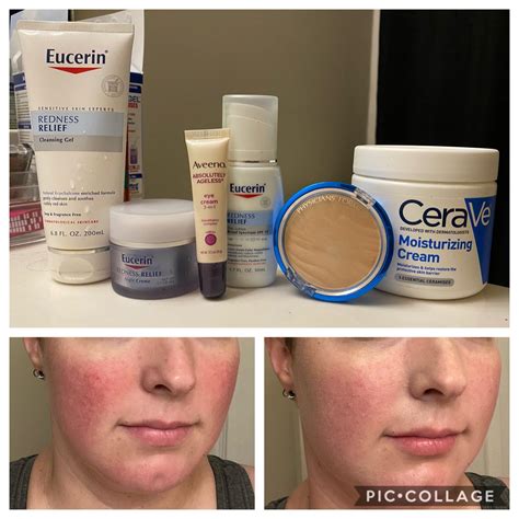 Critique My Skincare Routine Details In Comments R 30plusskincare