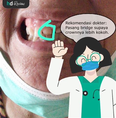 Review Crown Gigi Di Klinik Gigi Dewi Hdmall