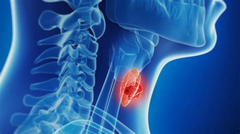 Safe To Expand Limits Of Active Surveillance In Thyroid Cancer MedMDS