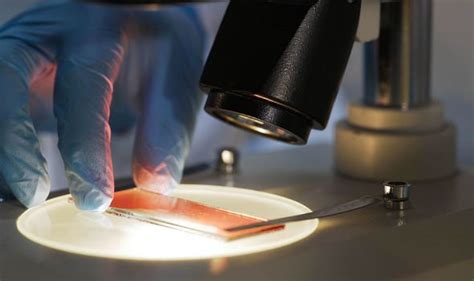 Leukaemia Breakthrough Major Discovery Sees Huge Breakthrough In