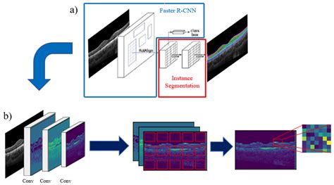 sensors free full text oct retinal and choroidal layer instance
