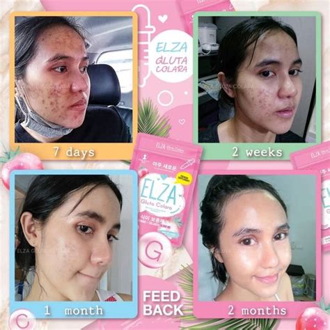 Viên Uống Trắng Da Tăng Đề Kháng Elsa Gluta Corala 60 Viên Thái Lan