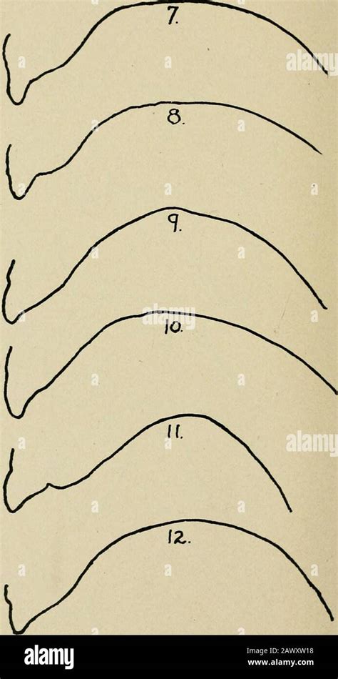 The Etiology Of Osseous Deformities Of The Head Face Jaws And Teeth