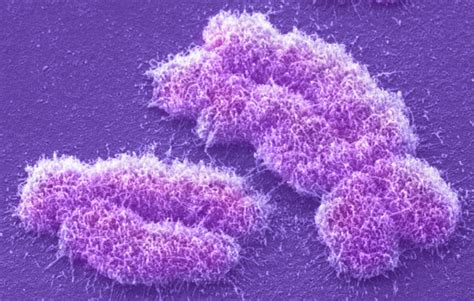 染色体变异分两大类，染色体变异详细介绍 孕育百科