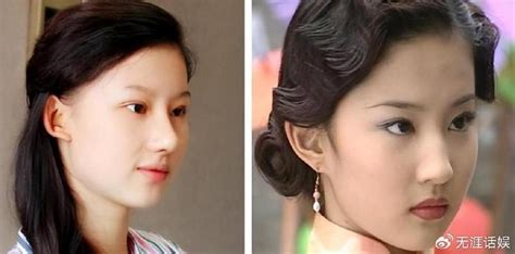 19岁少女执意整成“刘亦菲”，连名字也高仿，8年后她现状怎样？李奕霏刘亦菲整容新浪新闻
