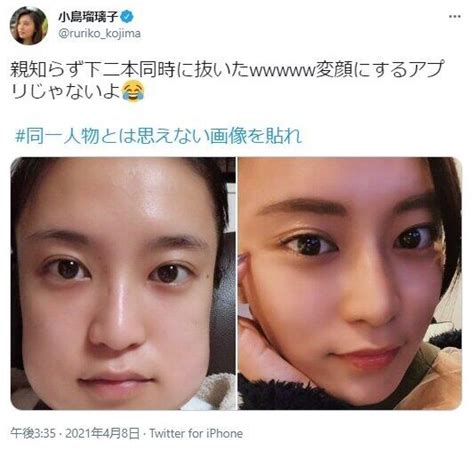 こじるり、本田翼、指原莉乃 女性芸能人はなぜ「親知らず抜いた」写真を公開したがるのか J Cast ニュース
