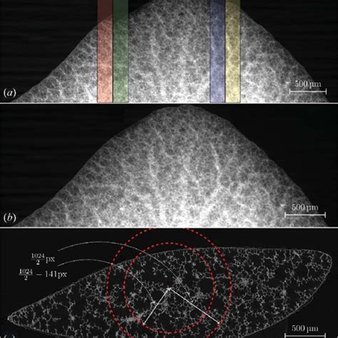 Pdf Radiation Dose Optimized Lateral Expansion Of The Field Of View In Synchrotron Radiation X