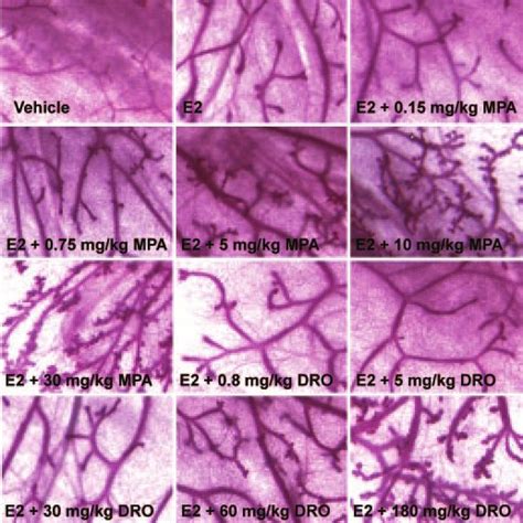 Mammary Gland Whole Mount Analysis C57bl6 Females Were Ovariectomized