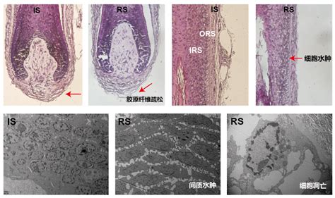 最前线 头秃者的新福音，细胞冻存技术提升毛囊存活率 创氪 中国网