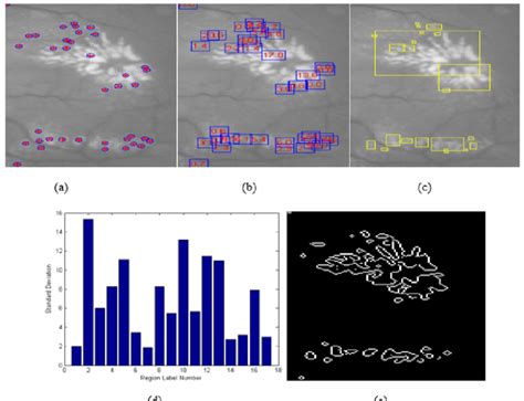results of drusen detection a weighted centroid of components b