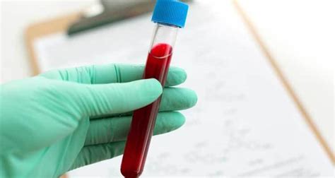 Enterocolite Necrosante Mind Map