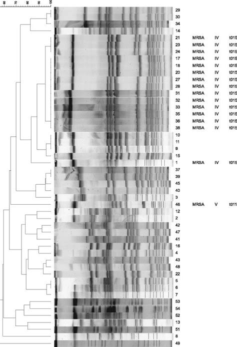 Results Of PFGE SCC Mec And Spa Typing Of S Aureus Isolates