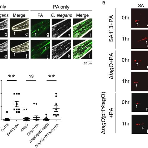 Influence Of Wta In The Hitchhiking Motility Of Staphylococcus Aureus Download Scientific
