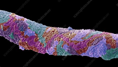 Skin Bacteria Sem Stock Image C054 2777 Science Photo Library