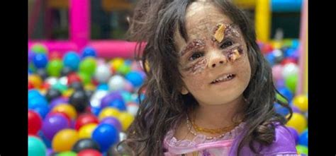 Девочка с маской Бэтмена не приедет в Краснодар из за заболевания мамы