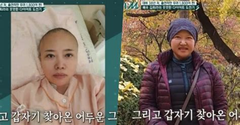 김희라 유방암 2기 완치치료 한 번 받으니 머리카락 다 빠져프리한닥터 조선비즈