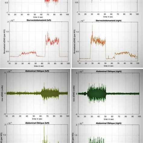 Schematic Representation Of The Location Of Surface Electromyography Download Scientific