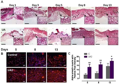Histological Features Of Wound Healing In Mice Treated With UA2 Or