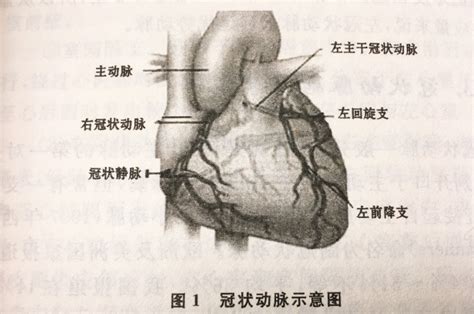 什么是冠状动脉？冠状动脉的分布分为几型 知乎