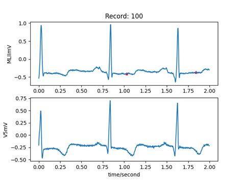Plotwfdb Times Dont Math For Annotation And Record · Issue 162