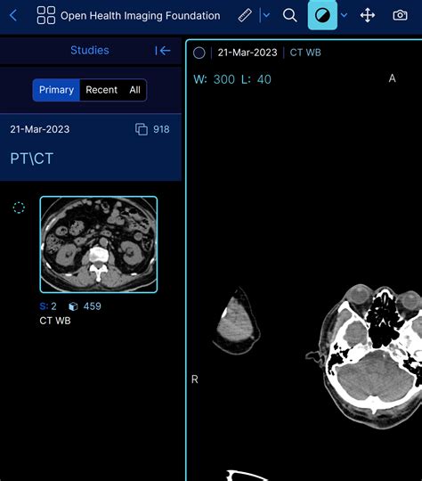 Bug Pet Serie Lost In Basic Viewer Issue Ohif Viewers Github