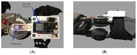 evaluation of a smart knee brace for range of motion and velocity