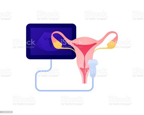 의료 초음파 절차 개념 벡터 플랫 헬스케어 일러스트레이션 여성 생식 시스템 및 자궁 진단 색상 아이콘 기호 초음파 장치 기호 건강 관리를 위한 디자인 자궁내막증에 대한 스톡
