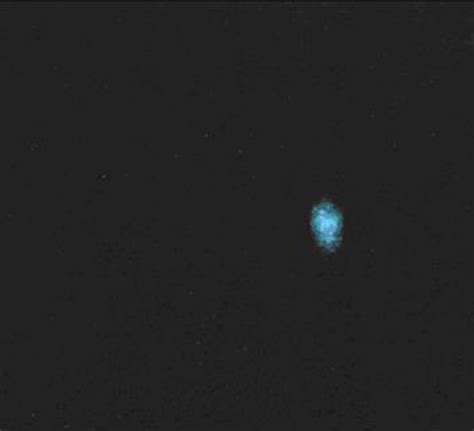 The Patients Last 99mtc Pertechnetate Thyroid Scan Showing An