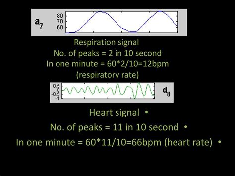 Ppt Separation Of Heart And Respiration Signals Using Matlab Powerpoint Presentation Id 1087081