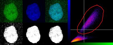 Patch Processing ImageJ Script For Determining Nucleus Cytoplasm Ratio Image Analysis Image