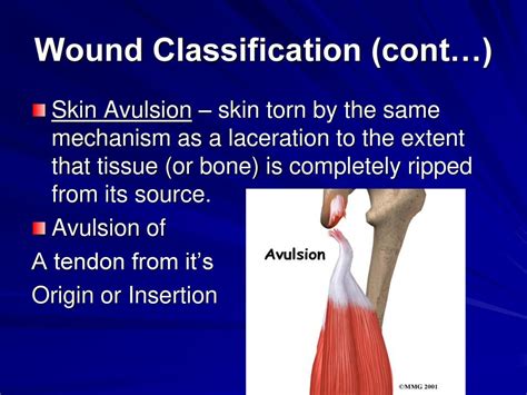 Intro To Sports Med And Athletic Training Ppt Download