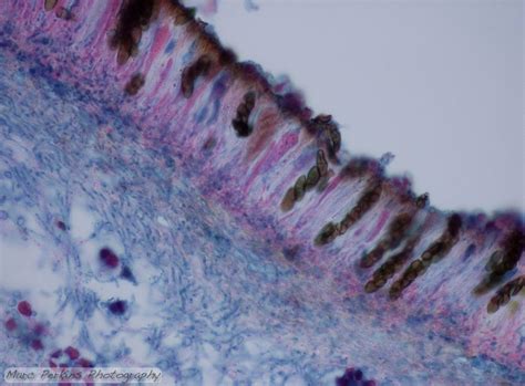 Cross Section Through A Lichen Ascocarp Fruiting Body The Hymenium
