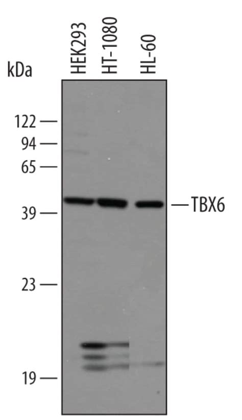 Human Tbx6 Antibody R D Systems 100μg Unlabeledantibodies