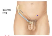 Abdominal Pain II Flashcards Quizlet
