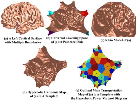 Shape Analysis With Hyperbolic Wasserstein Distance Geometry Systems