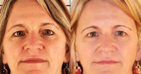 Chinese Acupressure Facelift Toning Exercises To Look Years Younger