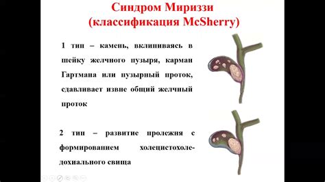 Механическая желтуха Youtube