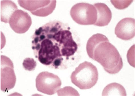 Hema Lec Nonmalignant Leukocyte Disorders Flashcards Quizlet