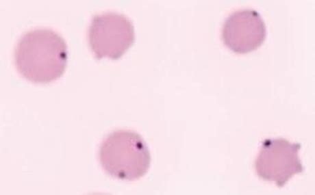 Lecture 6 Regenerative Anemia Flashcards Quizlet